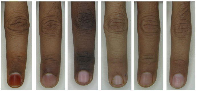 The Hong Kong Polytechnic University Finger Image Database, Version 1.0